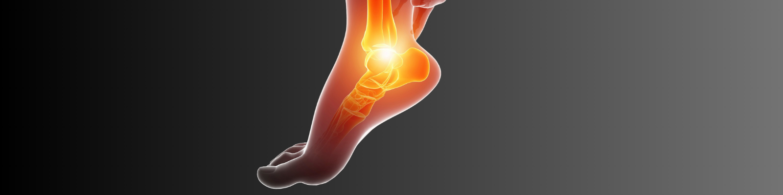 » Técnicas de rehabilitación para pacientes con talalgia crónica ...